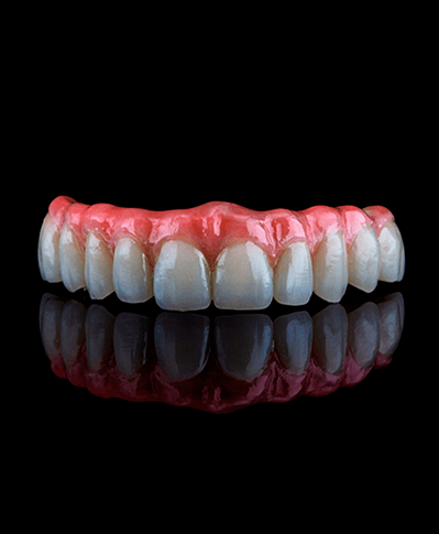 Implantes Dentários na Barra da Tijuca - Clínica OdontoBarra